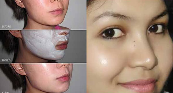 How to get spotless skin & make it glowing