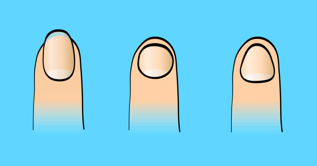 Types Of Fingernail Shape Which Will Reveal About Your Personality