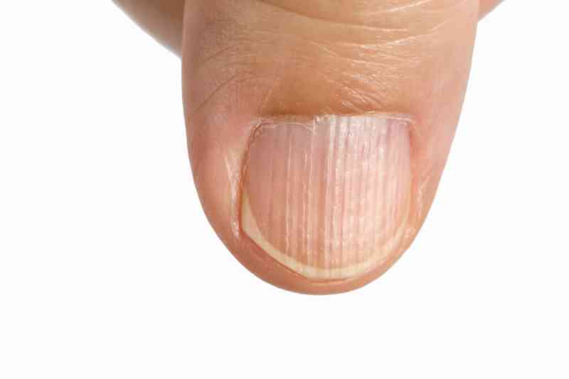 What Does Your Fingernails Indicate About Your Health